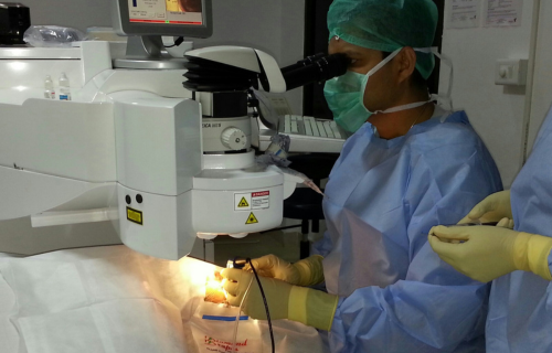 Top Advanced Refractive Surgery at Orient Eye Hospital, Hyderabad